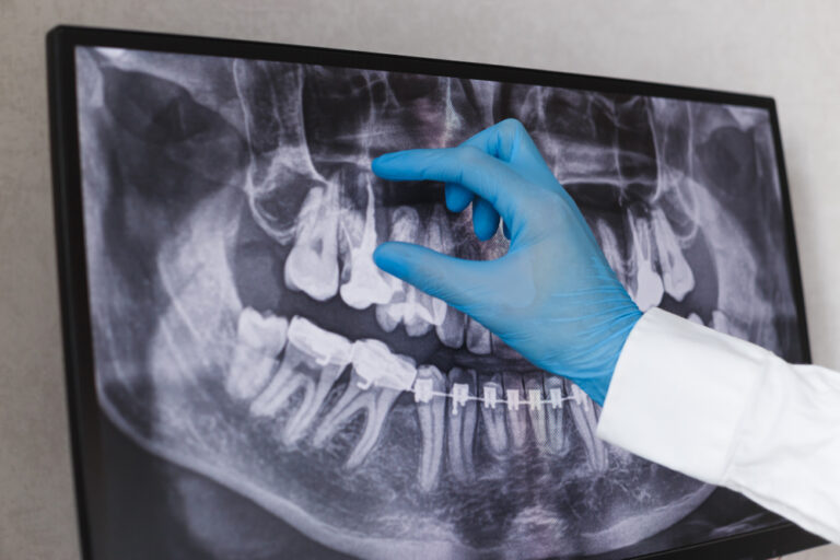 Say Goodbye to Fillings Soon? Scientists Just Grew Real Human Teeth In ...